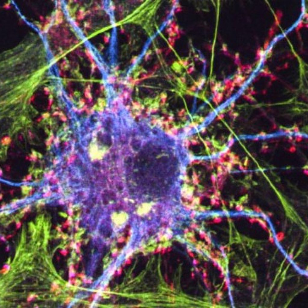 Psychedelic Drugs Could be the Answer - Psychedelic Research in Science ...